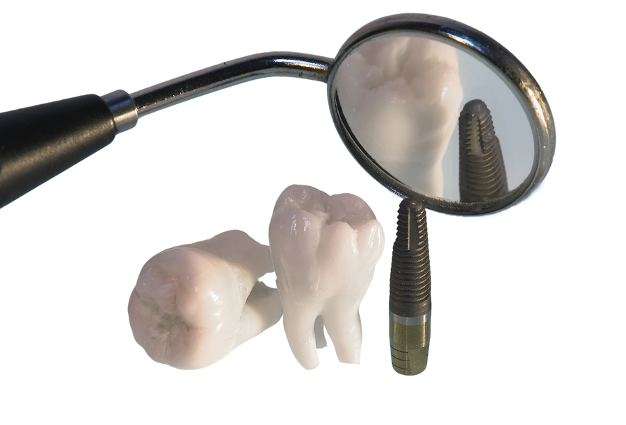 Permanent Solutions - Shine Dental Associates