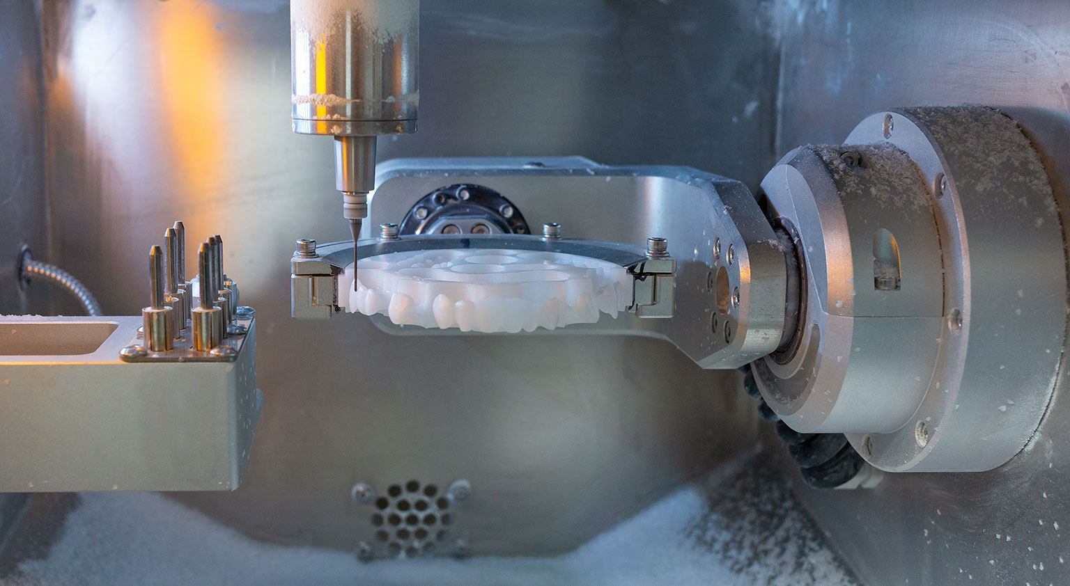 How a 3D Digital Lab Transforms Dental Implant Results